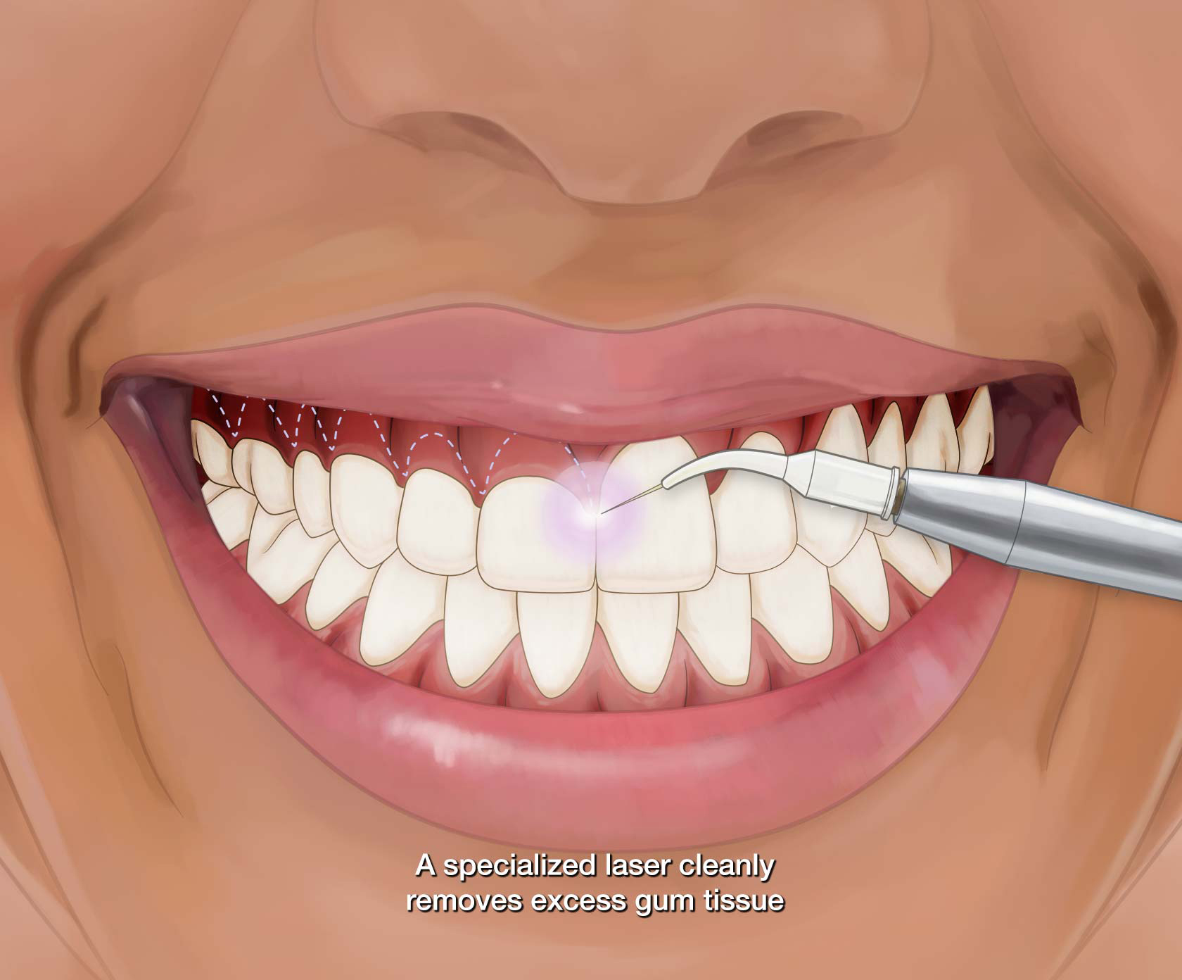 Dental Surgery